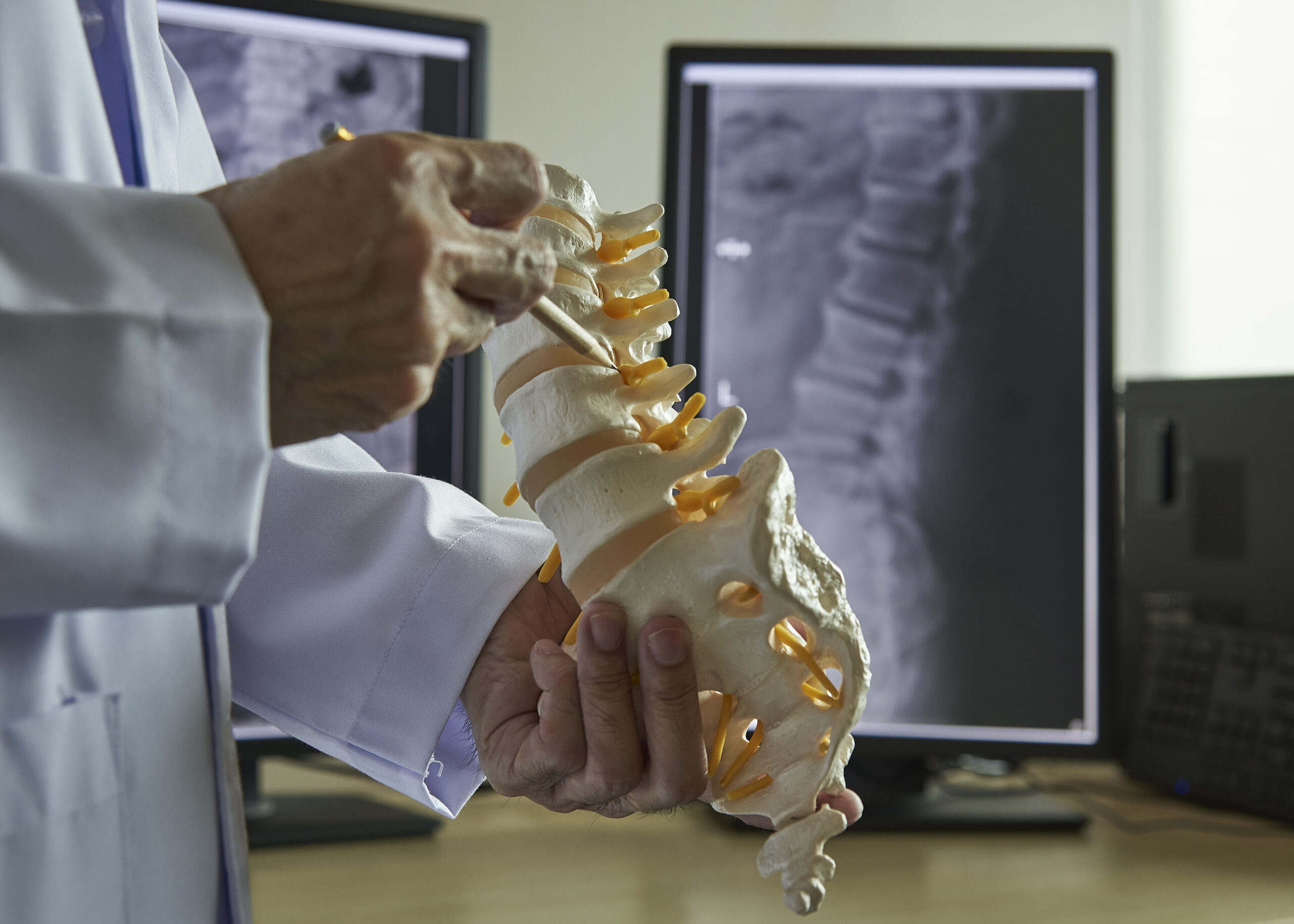 Sacral Insufficiency Fractures - Sacroplasty - Austin - Summit IR